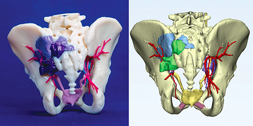Defining Radiology’s Role in the 3-D Printing Explosion | RSNA
