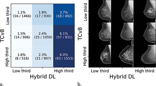 AI-for-breast-cancer-risk | RSNA