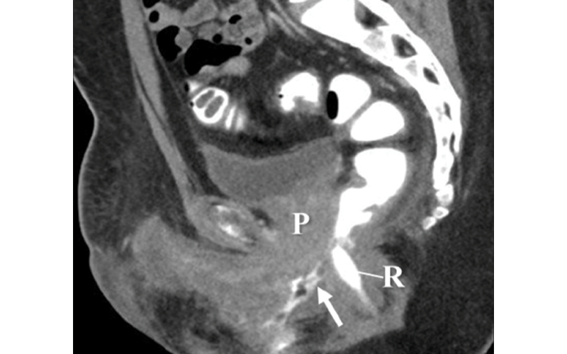 Trangender-Imaging | RSNA
