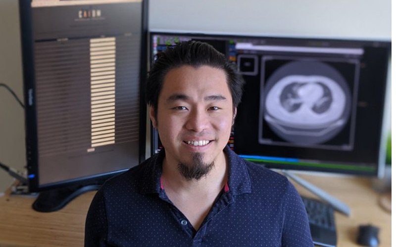 Radiologists Develop AI Tool to Identify Risk of COVID Complications | RSNA