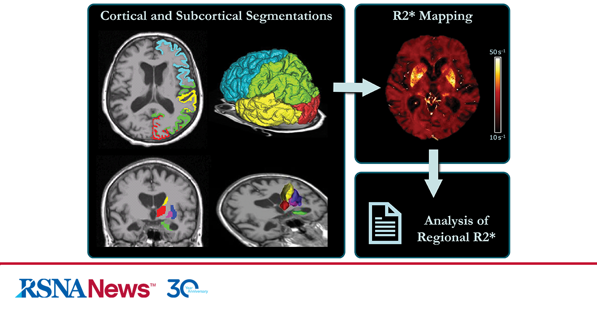 Brain-Iron-Accumulation | RSNA