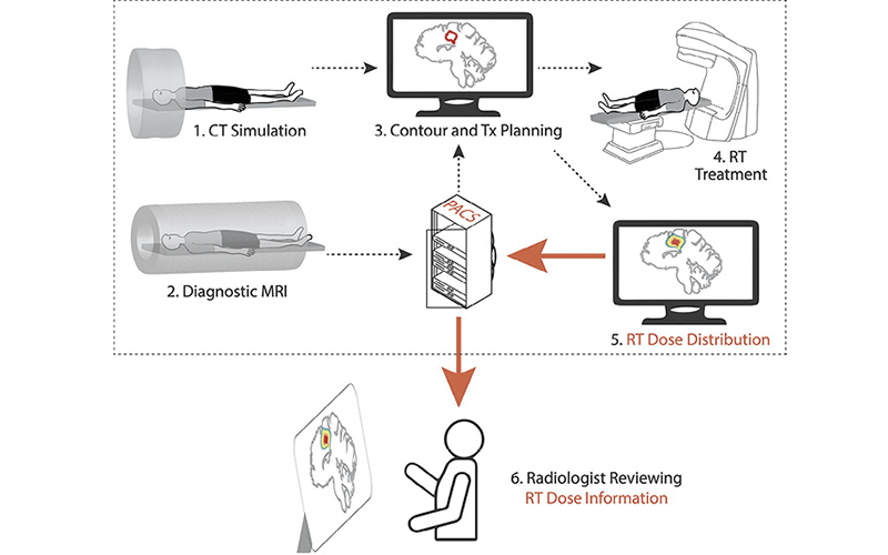 Radiation Dose Distribution Maps | RSNA