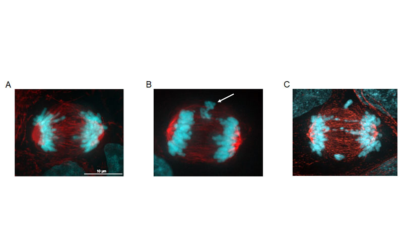 Chromosomal Instability Radiation Sensitivity | RSNA