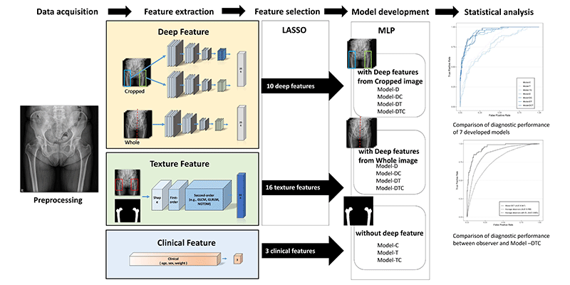 AI For Osteoporosis Diagnosis | RSNA
