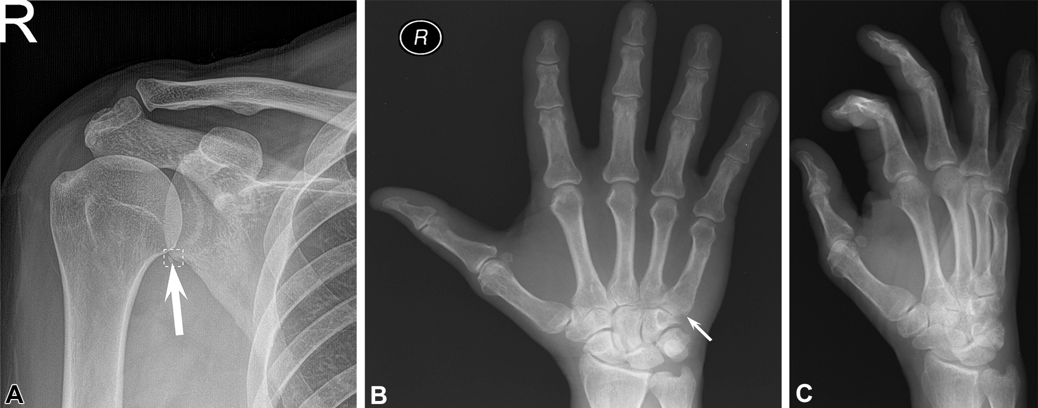 2022 Margulis | RSNA