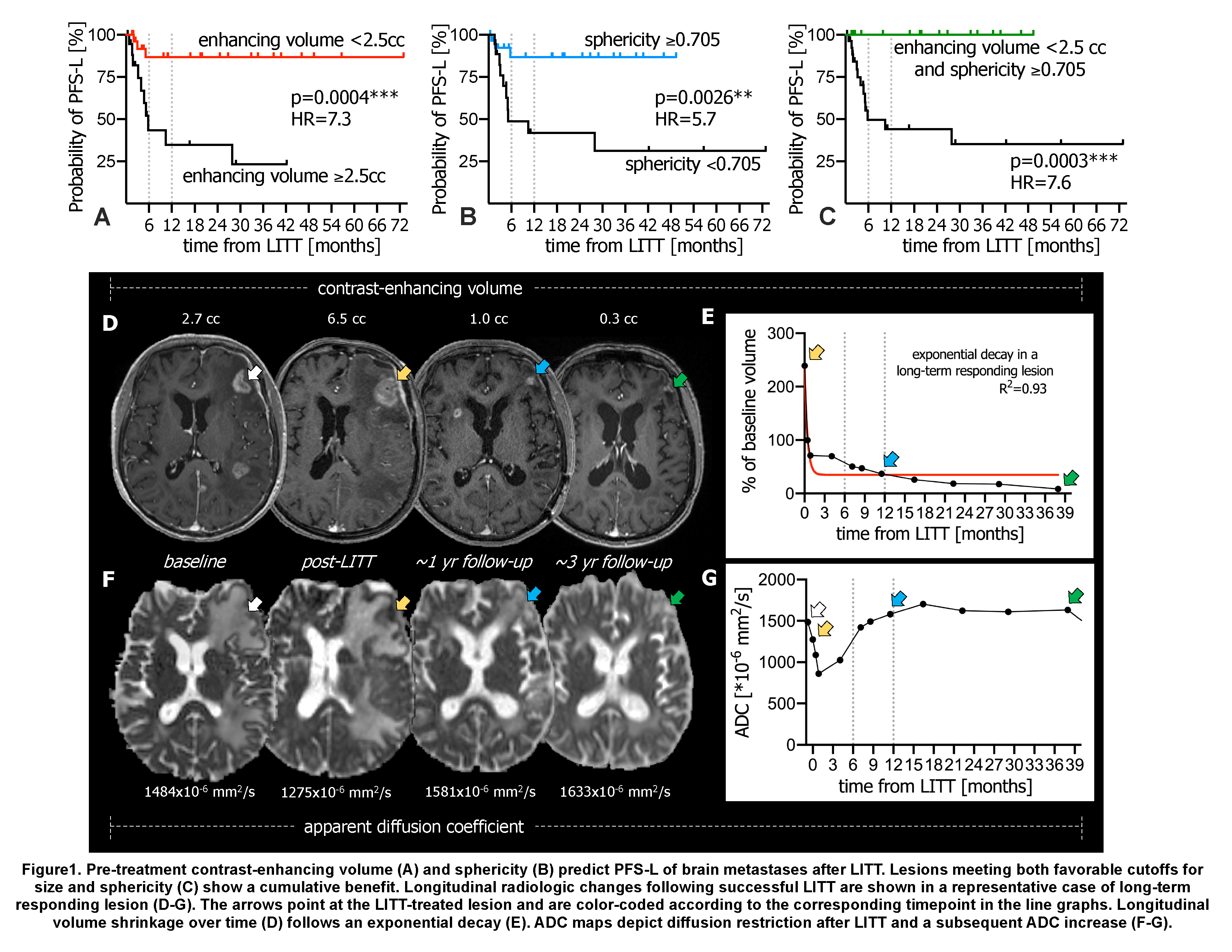 RSNA News | RSNA