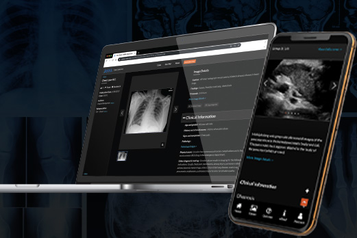 Radiological Society of North America | RSNA