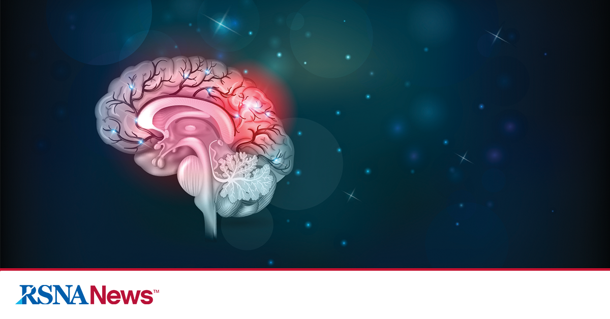 Acute Ischemic Stroke | RSNA