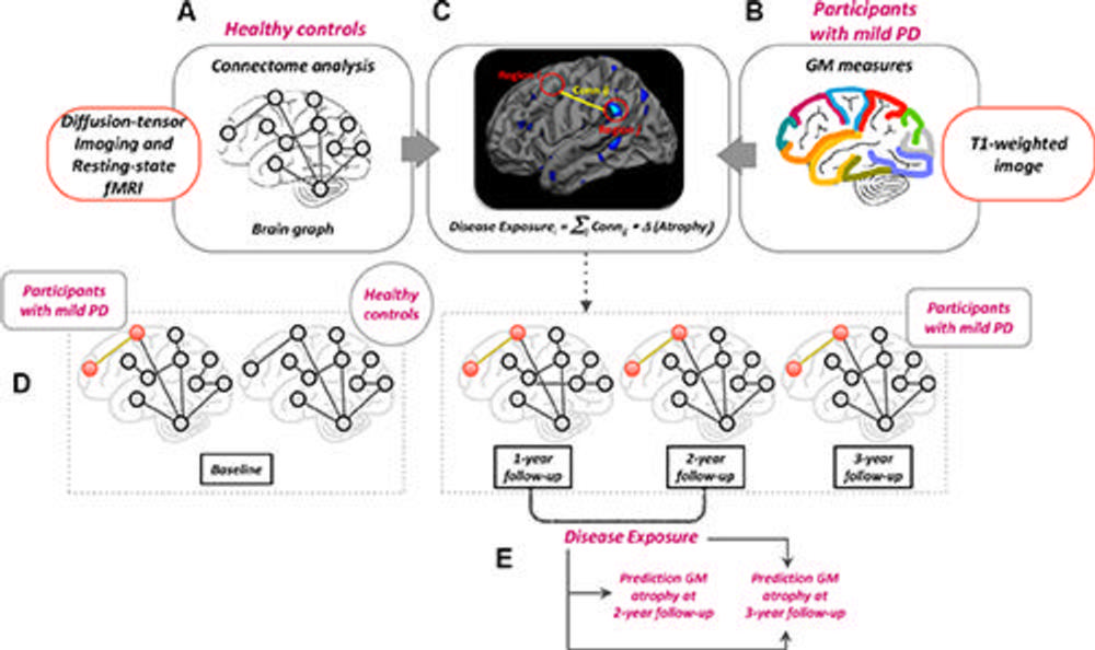 Brain Connectivity on MRI Predicts Parkinson’s Disease Progression | RSNA